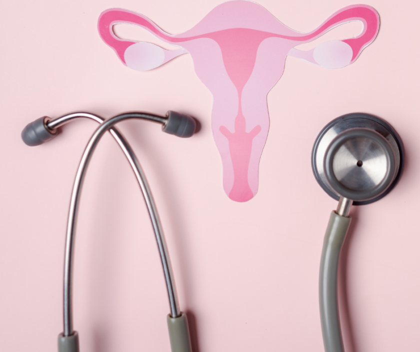 Σύνδρομο πολυκυστικών ωοθηκών (PCOS) - Κυπραίος Νικόλαος