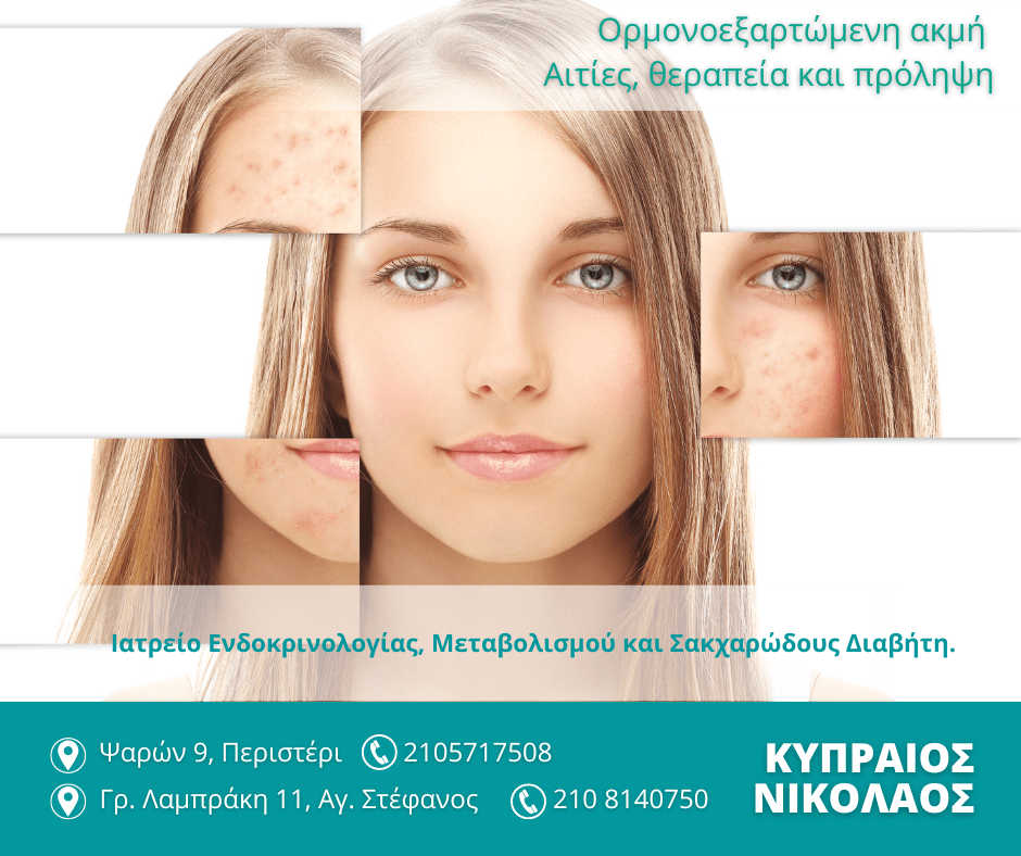 Ορμονοεξαρτώμενη ακμή: Αιτίες, θεραπεία και πρόληψη